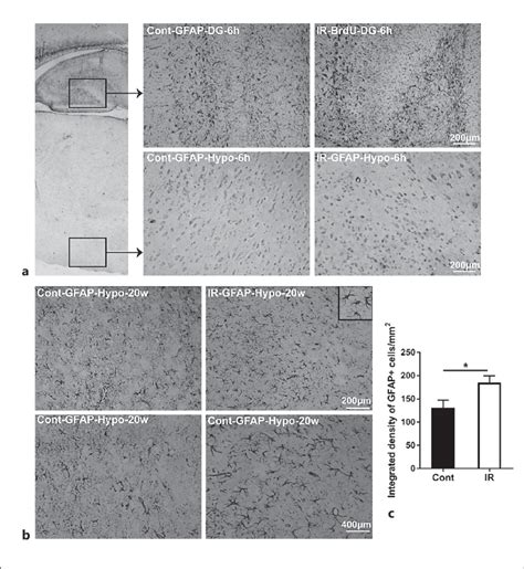 Irradiation Induces Late Astrocyte Reactivity In The Hypothalamus A