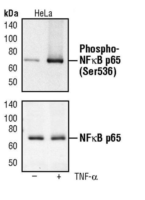 Phospho Nfkb P65 Ser536 Antibody Ma5 15160