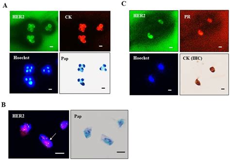 Subtyping Of Ctcs By The Current Cytology Based Ctc Detection Method Download Scientific