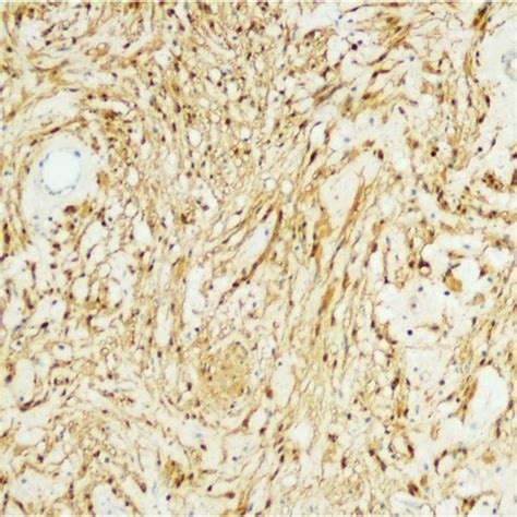 Morphological Examination Residual Lymph Node Tissue At The Periphery Download Scientific