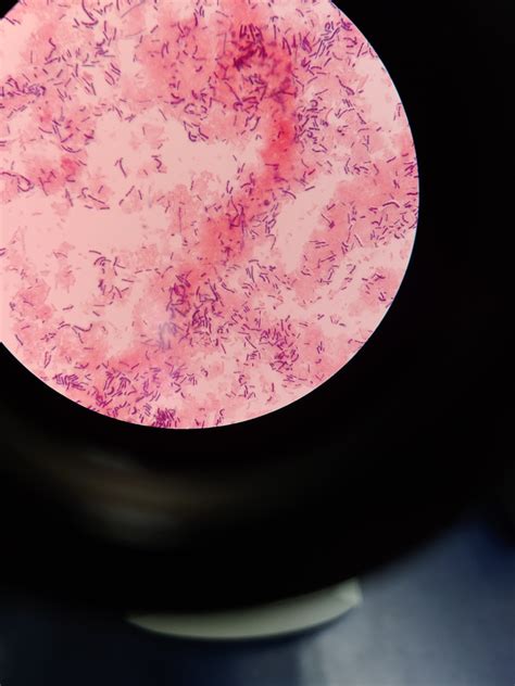 72 Questions With Answers In Gram Staining Scientific Method