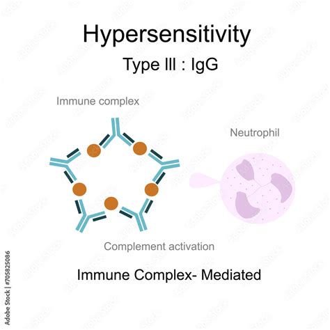 The Diagram Of Hypersensitivity Type Lll Immune Complex Mediated