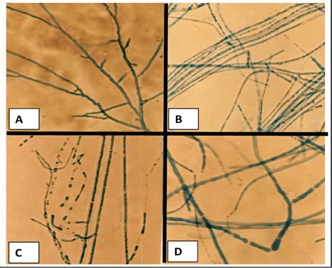 Morphological Behavior Of Trichoderma Harzianum A Control Culture B Download Scientific