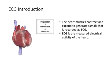 Iot Based Ecg Monitoring System Using Node Mcu Pptx Digital Audio Computer Software And