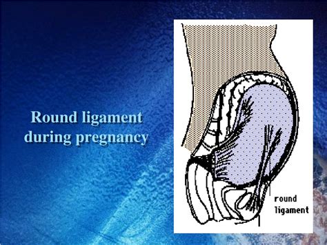 Round Ligament Pain Early Second Pregnancy At Wilbur Pritt Blog