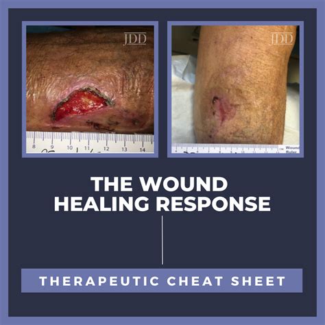 Wound Healing Steps Horse Wound Care Step By Step