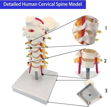 Medical Anatomy Human Cervical Spine Model Cervical Spine And Carotid Artery Teaching Model