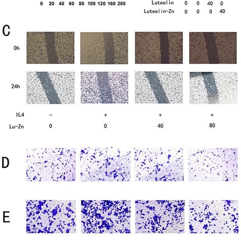 Toxicity Assay Of Lu Zn And Its Effect On Cell Migration And Invasion