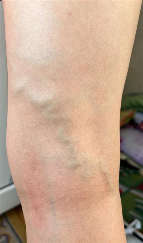 Судас Бүдүүрэх Нарийсах Хатуурах Sudas Buduureh Nariisah Hatiurah ☑️ Hulnii Ar Taliin