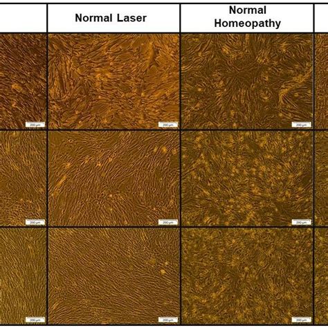 Shown Is The Morphology Of Normal Cell Models Treatment With Laser