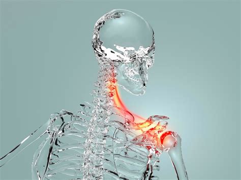 Premium Photo Illustration About Human Osteomyelitis Medical