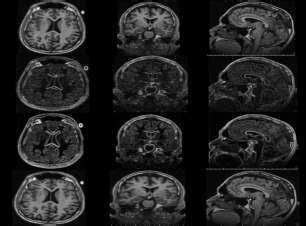 Images Before And After Filtering Download Scientific Diagram
