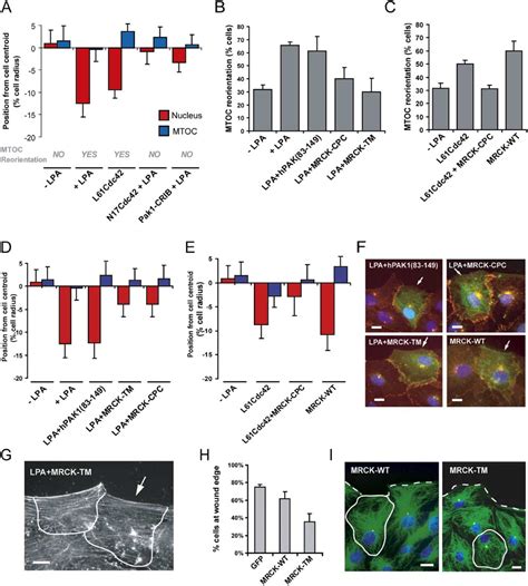 Microtubule Organizing Center Semantic Scholar