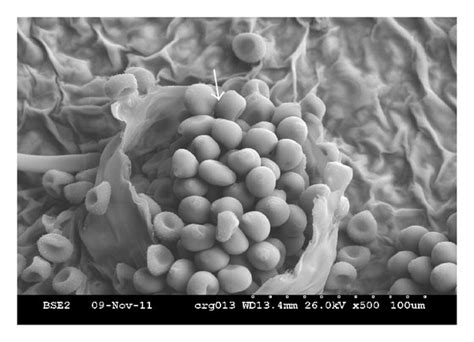 Common Bean Rust Symptoms Rust Pustules And Spores A Ten Day Old Download Scientific