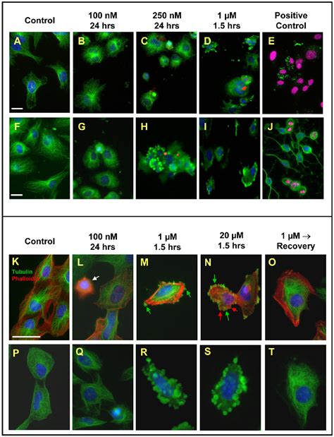 Figure 1 From Interference With Endothelial Cell Function By Jg 03 14