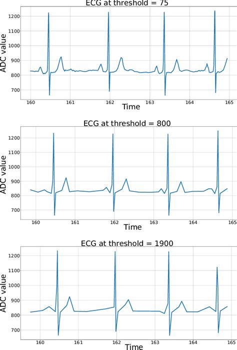 ECG Signal Sub Sampled With The Proposed Algorithm Using Three Download Scientific Diagram