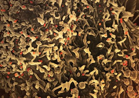 5 Things to Know About Mpox (Monkeypox) - Embrace Relief Foundation