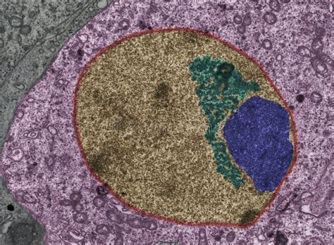 Sex Vesicle Tem Stock Image Image Of Electron Biology 101292791