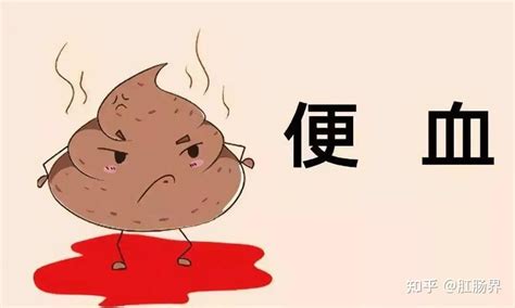 大便出血的4种情况 有一种都要警惕 知乎