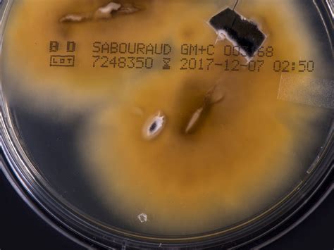 Labopart Trichophyton Indotineae