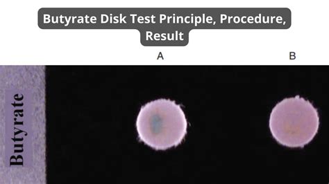 Simmons Citrate Agar Test Procedure Principle Result Example
