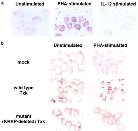 Expression And Localization Of Txk In Human T Cells A Nuclear