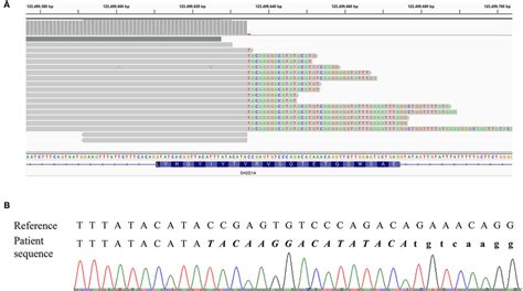 Dna Result Of The Patient A Igv Snapshot Of A Next Generation