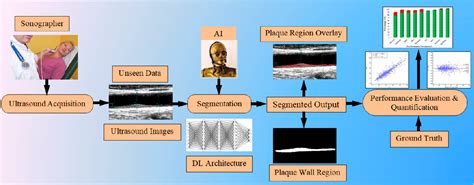 Figure 1 From Unseen Artificial Intelligence—deep Learning Paradigm For