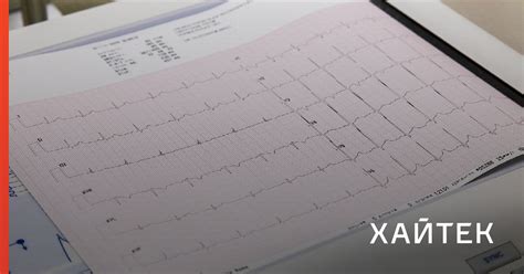 Data Science в медицине кардио МРТ с ИИ умное планирование лучевой терапии и случайное