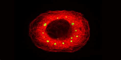 Membraneless Organelles Interact With The Cytoskeleton Inside The Cell Department Of Materials