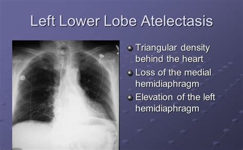 Thread By Morexgrok On Thread Reader App Thread Reader App