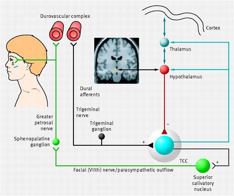 Cluster Headache Pathophysiology