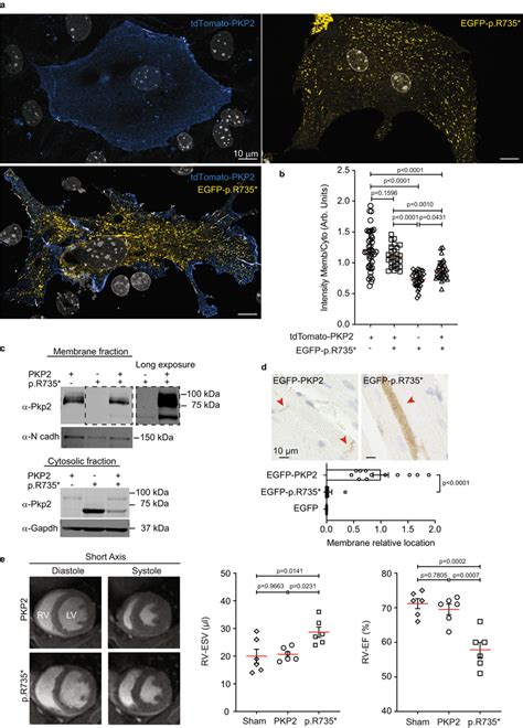 Pkp2 C Terminal Deletion Modifies Its Subcellular Localization And