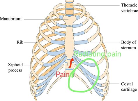 Xiphoid Process Pain Sternum Anatomy Parts Pain And Diagram