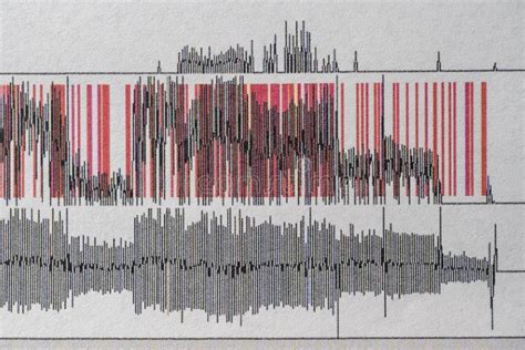 Images Charts Scientific Cardiograms Of Cardiorespiratory Sleep Monitoring Heart Pulse Or Heart