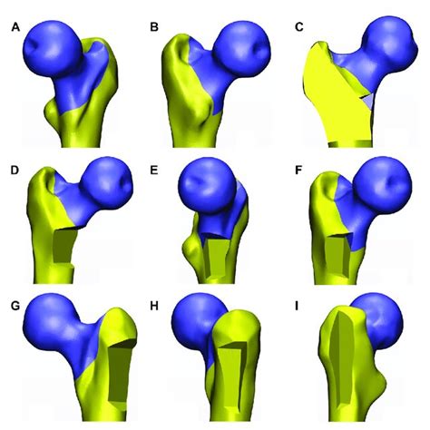 The Diagram Exhibited The Constructed Eight Fracture Models Based On Download Scientific