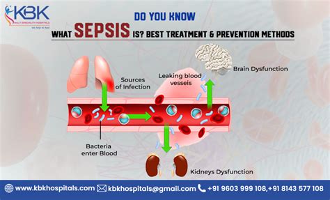 Sepsis Symptoms