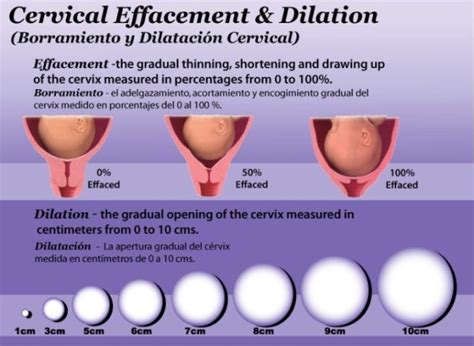 Cervical Effacement Cervix Thinning Signs Your Cervix Is 57 Off