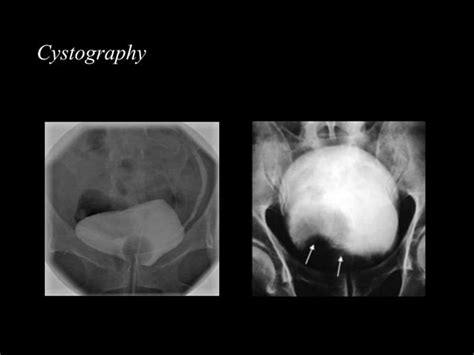 Imaging Of Urinary Bladder And Urethra Pptx Medical Tests Medical