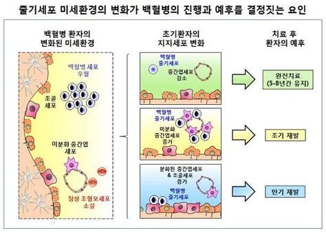 세계최초 줄기세포의 변화로 백혈병 환자의 치료결과 예측 가능한 기술 개발 아주경제