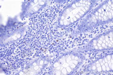 Foxp3 Antibody 68803 2 Ig Proteintech