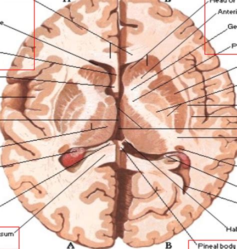 Horizontal Section Through Cerebral Hemispheres Diagram Quizlet