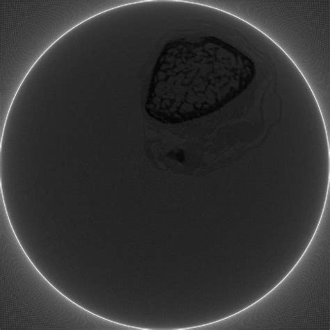 A Top Filtered Backprojection Fbp Reconstruction Of The Sinogram Download Scientific