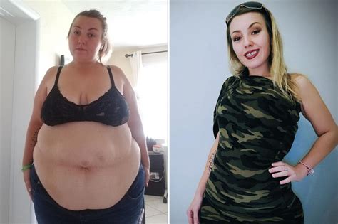 New York Post On Twitter I Lost Pounds But It Ruined My Sex