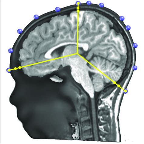 Pdf Eeg Source Imaging A Practical Review Of The Analysis Steps