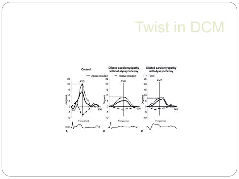 Speckle Tracking Echocardiography Pptx