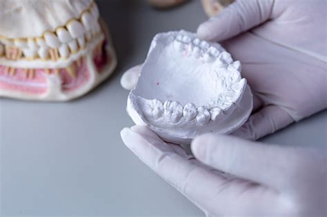 연구 진단 캐스트 및 치과 실험실에서 치과 석고 모델의 캐스팅 개념에 대한 스톡 사진 및 기타 이미지 개념 건강 진단