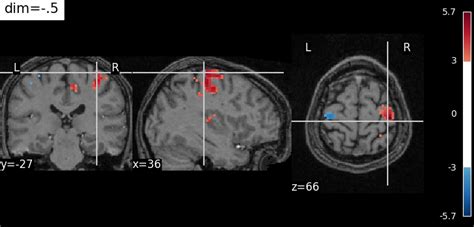 Controlling The Contrast Of The Background When Plotting Nilearn