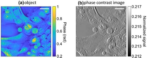 computational phase contrast imaging results a representative phase