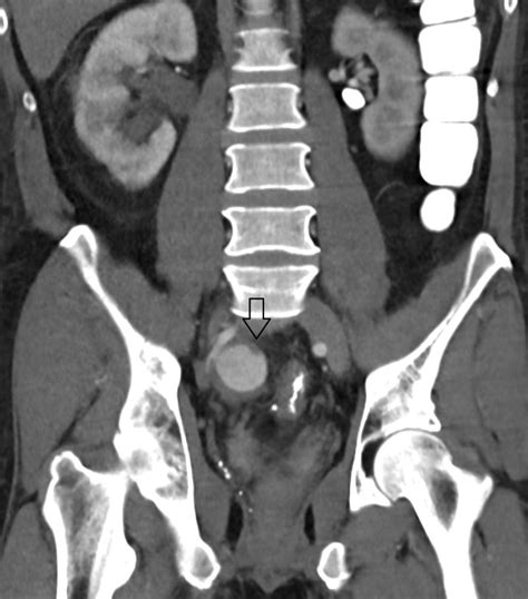 Dr Med Theodor Lutz Mhba On Linkedin Radiology Interventionalradiology Dsa Angiography